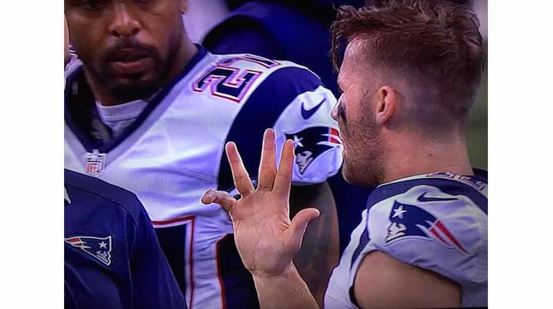 Julian Edelman Busts Up His Pinky Catching TD Pass | Muscle & Fitness