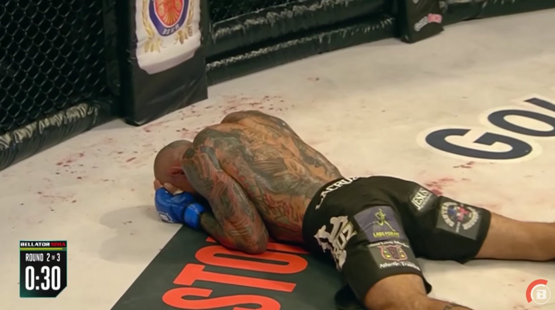 Evangelista 'Cyborg' Santos Suffers Horrific Skull Fracture in MMA Bout ...